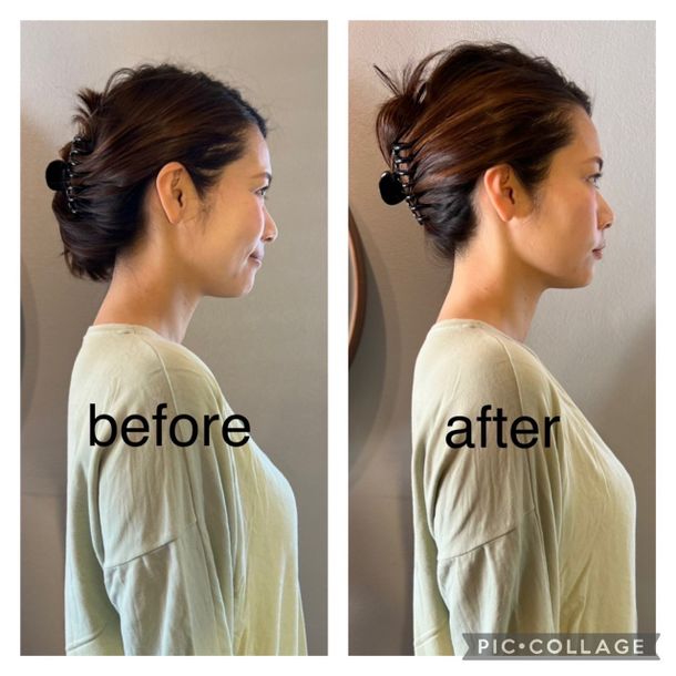 首のプロポーションを改善！首専門整体 Neck Care RACINE「首やせ整体」 - ライブドアニュース