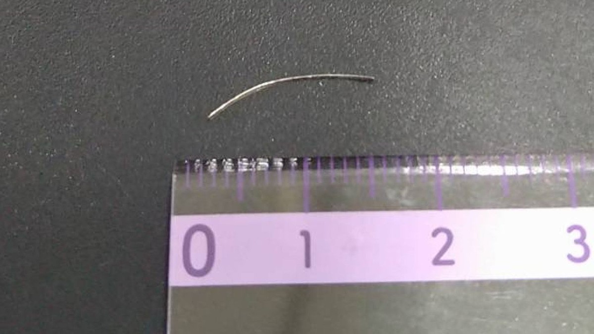 学校給食に異物混入が相次ぐ 高松市の小学校と丸亀市の中学校で【香川】 - ライブドアニュース