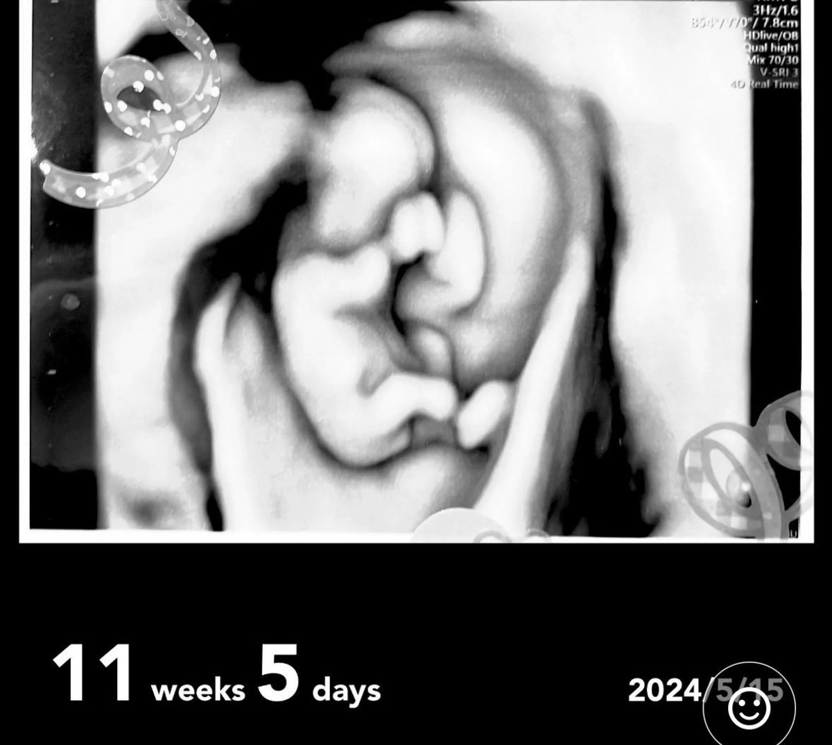 「え、まさか…？」5ヶ月の息子が見せる“ある寝相”に6.2万いいね「最高」「癒されました」【ママリ】 - ライブドアニュース