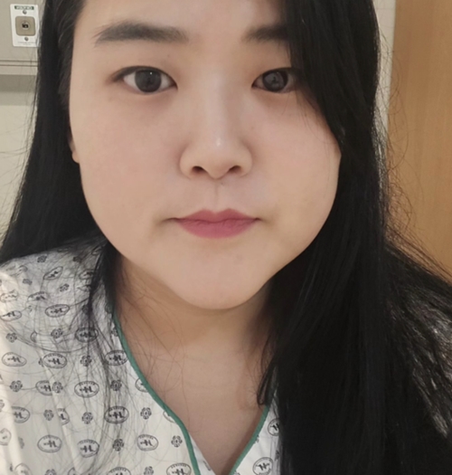 【画像】韓国歌手の義姉がダイエット成功！150kg→99kgの衝撃ビフォーアフター「腕の血管見える」【画像】 2/4 - ライブドアニュース